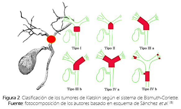 Tumor635